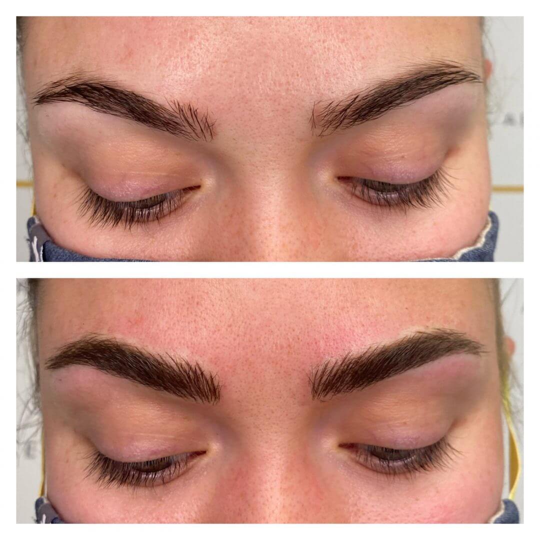 Custom Microblading Treatments | Arch & Crown Aesthetics